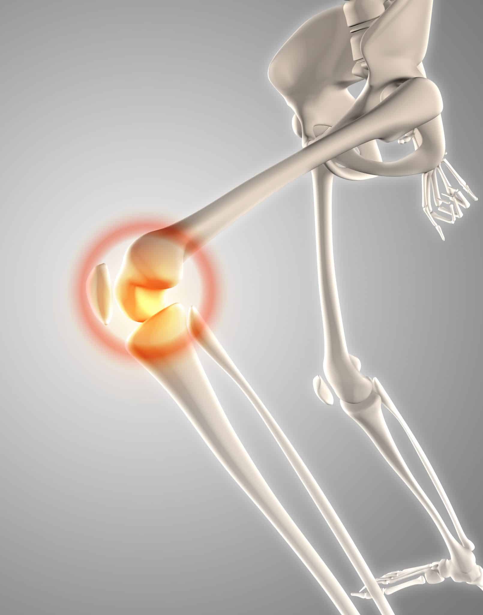 Total Knee Replacement Surgery in Singapore | Specialist & Cost