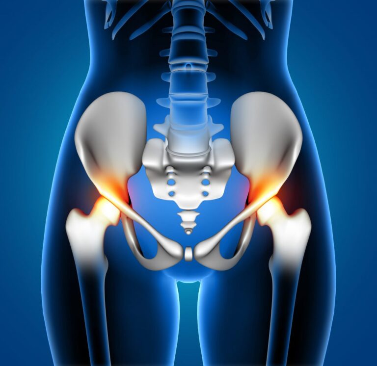 ERAS Total Hip Replacement Surgery Singapore | Cost & Specialist
